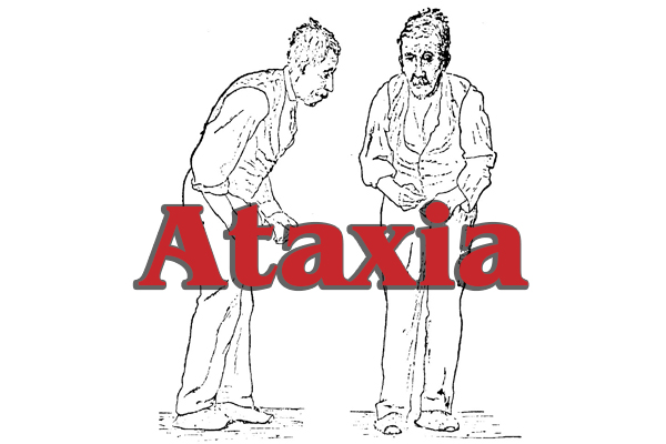 ¿Qué es la Ataxia? - Clinica Hispana Woodforest