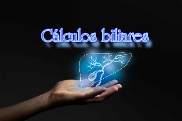 Cálculos biliares - Clinica Hispana Woodforest