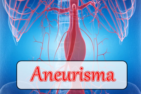 Aneurisma - Clinica Hispana Woodforest